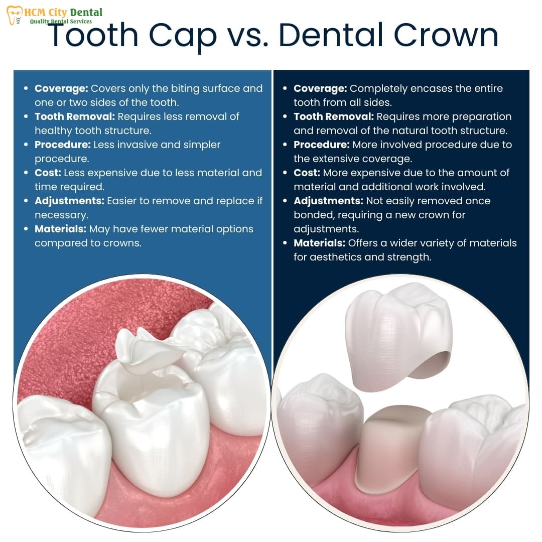 Dental Crown Cap: Flawless Smile Secrets [Guide] | Dr. Cuong - Ho Chi ...