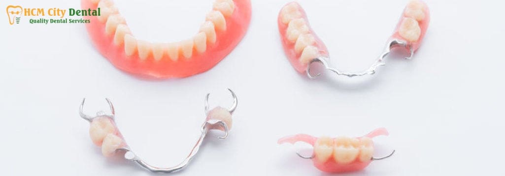 Denture Styles: Get a Natural Look [Expert Guide] | Dr. Cuong - Ho Chi ...