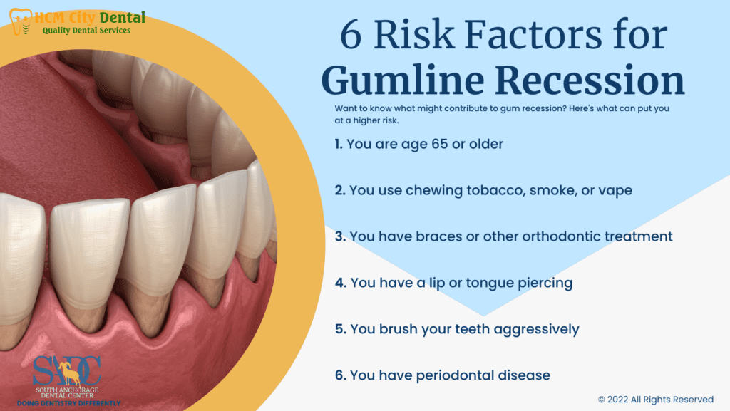 How to Repair Receding Gums: Stop & Heal Naturally | Dr. Cuong - Ho Chi ...