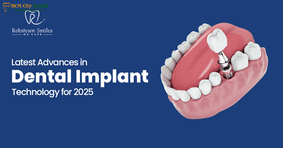New Technology Teeth Replacement: [Painless?] - Dr. Cuong - Ho Chi Minh ...
