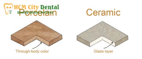 Porcelain vs Ceramic: Don't Choose Before Reading This! | Dr. Cuong ...