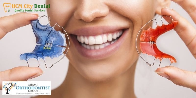 Removable Braces for Teeth: Perfect Your Smile | Dr. Cuong - Ho Chi ...