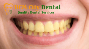 Yellow Teeth? Discover 5 Proven Ways to Whiten Yours! | Dr. Cuong - Ho ...